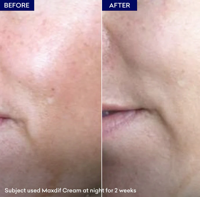 MAXDIF BRIGHTENING CREAM | 40g – abheea.pk